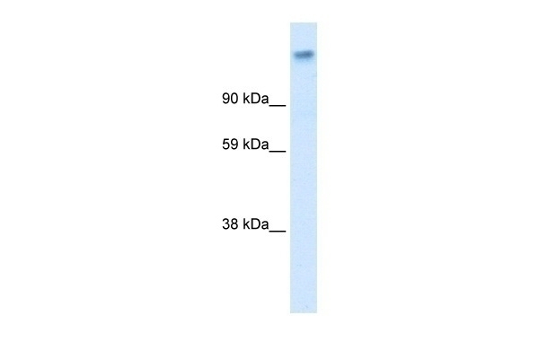 CACNA2D1 Antibody - Cat. No. 28-220 | ProSci