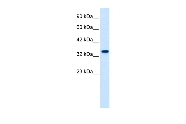 ZNF2 Antibody - Cat. No. 28-402 | ProSci