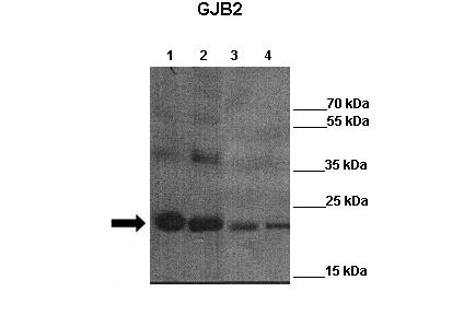 GJB2 Antibody - Cat. No. 28-527 | ProSci