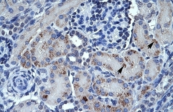 SPP1 Antibody - Cat. No. 28-547 | ProSci