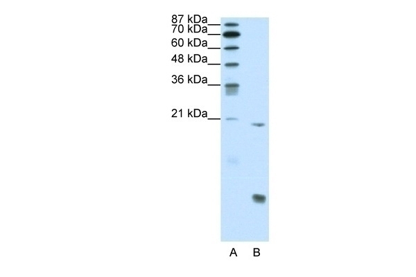 RUNX1 Antibody - Cat. No. 28-784 | ProSci