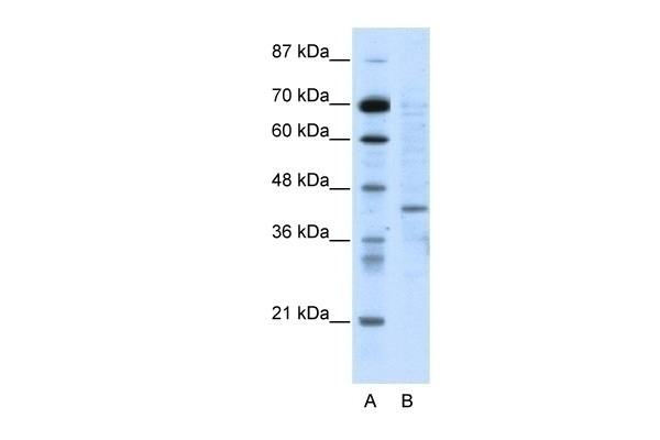 RING1 Antibody - Cat. No. 28-818 | ProSci