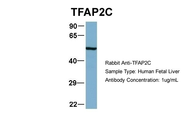TFAP2C Antibody - Cat. No. 28-839 | ProSci