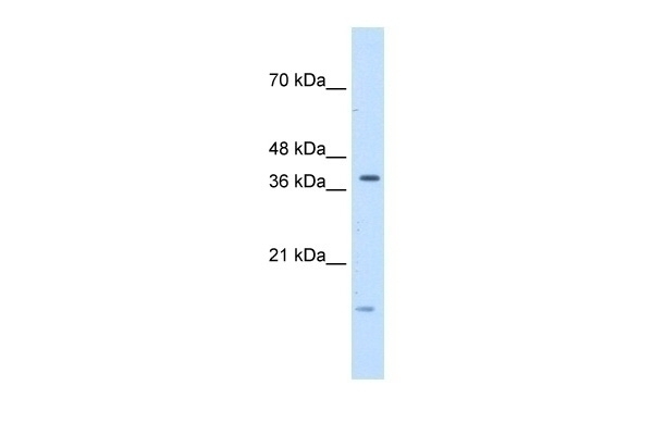 TFB2M Antibody - Cat. No. 29-083 | ProSci