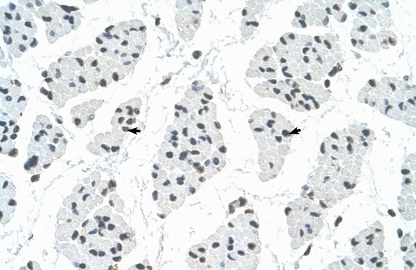 RBM22 Antibody - Cat. No. 29-442 | ProSci