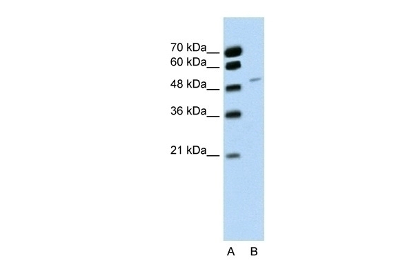 RBM22 Antibody - Cat. No. 29-442 | ProSci