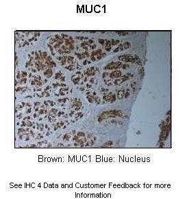 MUC1 Antibody - Cat. No. 29-576 | ProSci