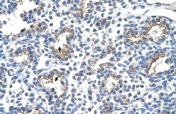 CEACAM6 Antibody - Cat. No. 29-589 | ProSci