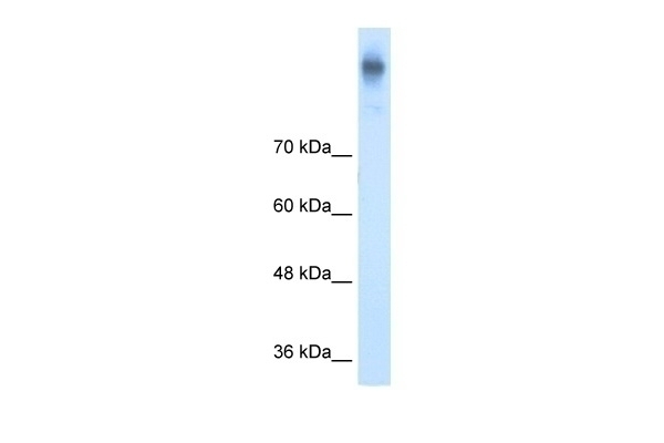 SLC12A2 Antibody - Cat. No. 29-906 | ProSci