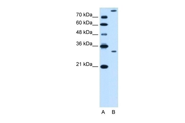 GZMK Antibody - Cat. No. 30-051 | ProSci
