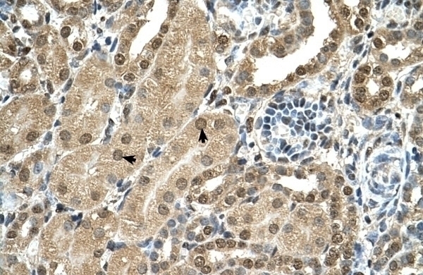 TBX15 Antibody - Cat. No. 30-316 | ProSci