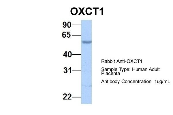 OXCT1 Antibody - Cat. No. 30-414 | ProSci
