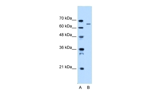 IVL Antibody - Cat. No. 30-432 | ProSci