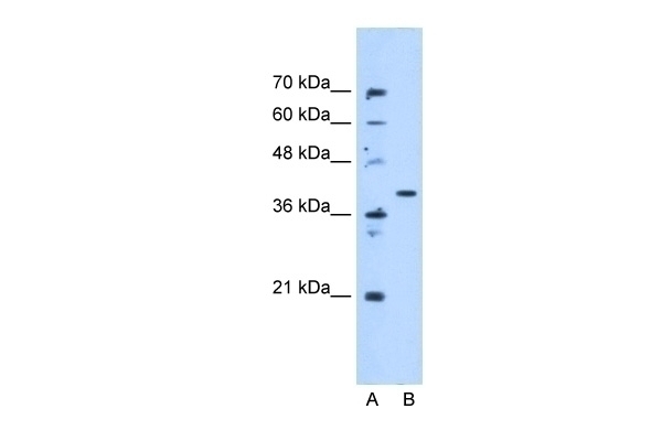 ECHDC3 Antibody - Cat. No. 30-472 | ProSci