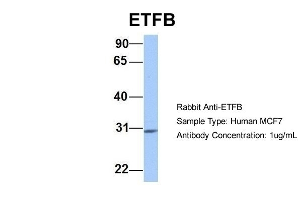 ETFB Antibody - Cat. No. 30-973 | ProSci