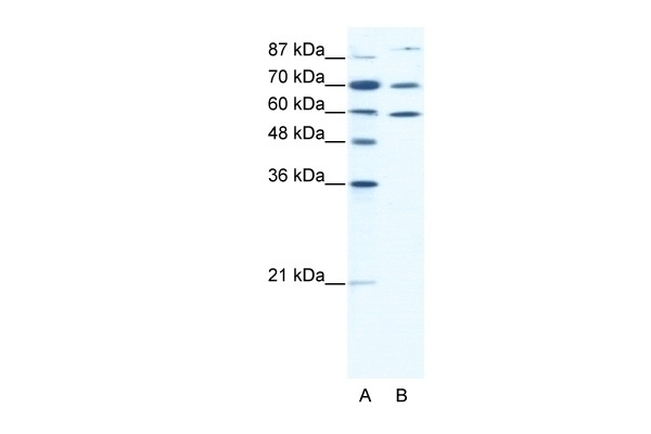 HSP90AB1 Antibody - Cat. No. 31-070 | ProSci