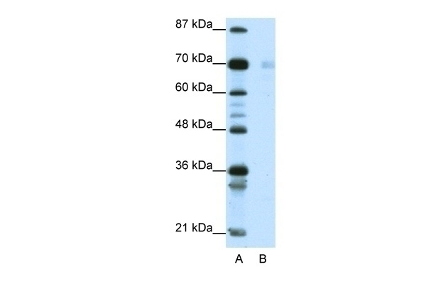 HSPCB Antibody - Cat. No. 31-072 | ProSci