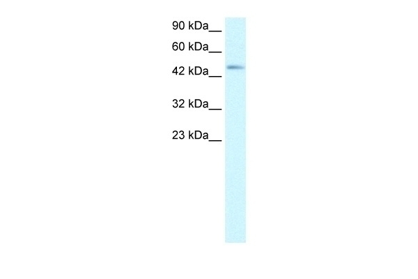 CCR8 Antibody - Cat. No. 31-087 | ProSci