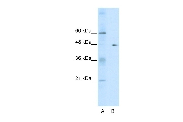 GDI2 Antibody - Cat. No. 31-109 | ProSci