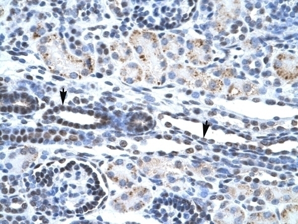 ETS1 Antibody - Cat. No. 31-151 | ProSci