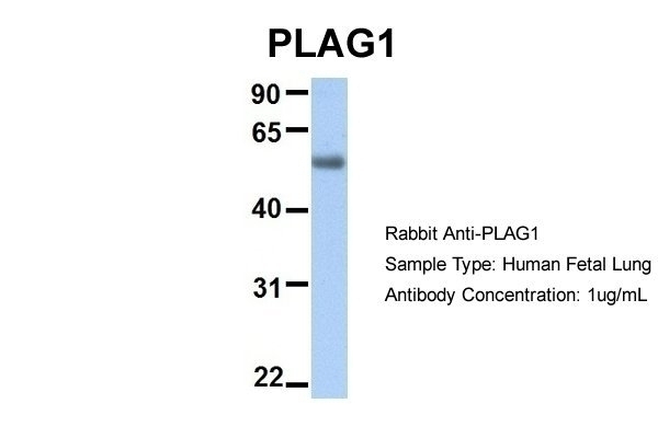 PLAG1 Antibody - Cat. No. 31-277 | ProSci