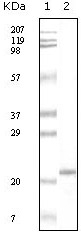 Apoa5(bd) Antibody [4H8H8E2(c)] - Cat. No. 32-110 | ProSci