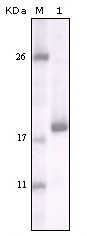 DDR2 Antibody [3B11E4] - Cat. No. 32-144 | ProSci