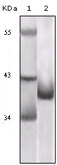 P16 Antibody [1E12E10] - Cat. No. 32-203 | ProSci