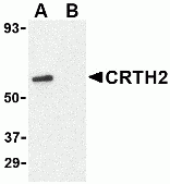 CRTH2 Peptide - Cat. No. 4027P | ProSci
