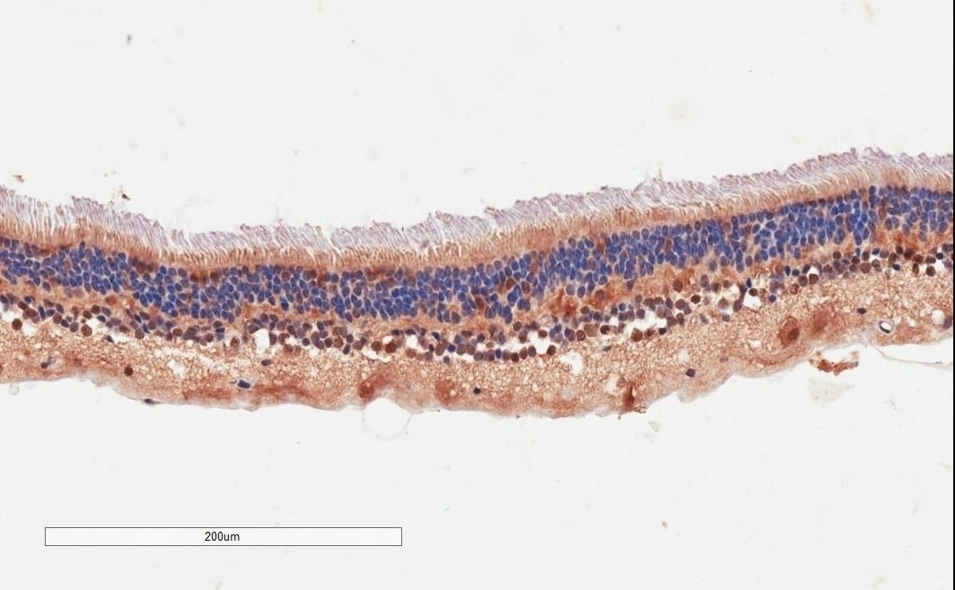 DIAPH1 Antibody - Cat. No. 42-285 | ProSci