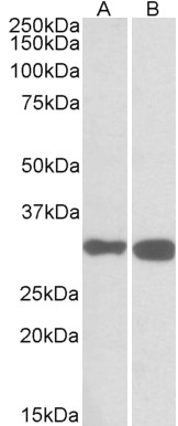 Unc13b Antibody - Cat. No. 42-327 | ProSci