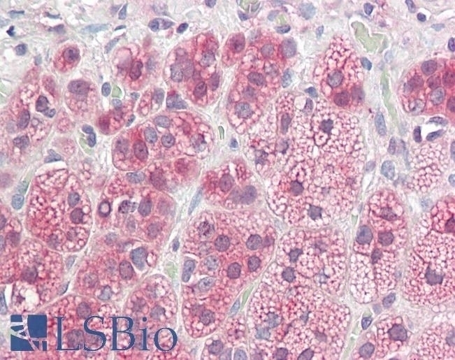 ZEB2 Antibody - Cat. No. 42-432 | ProSci