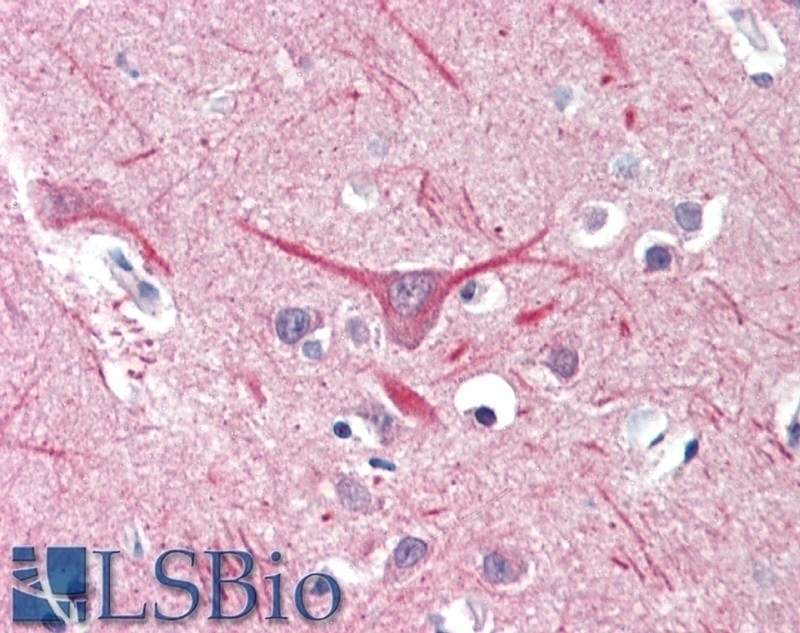 IKZF1 Antibody - Cat. No. 42-782 | ProSci