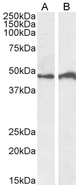 AKT2 Antibody - Cat. No. 42-963 | ProSci
