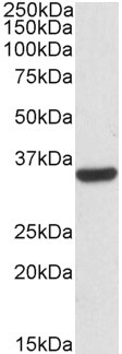 CA1 Antibody - Cat. No. 43-126 | ProSci