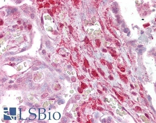 CA1 Antibody - Cat. No. 43-126 | ProSci