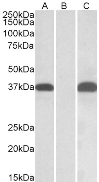 PRKCB Antibody - Cat. No. 43-319 | ProSci
