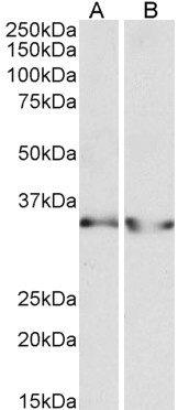 LDHA Antibody - Cat. No. 43-515 | ProSci