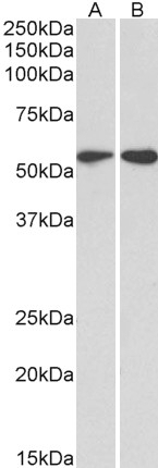 CD3-ZETA / CD247 Antibody - Cat. No. 43-634 | ProSci