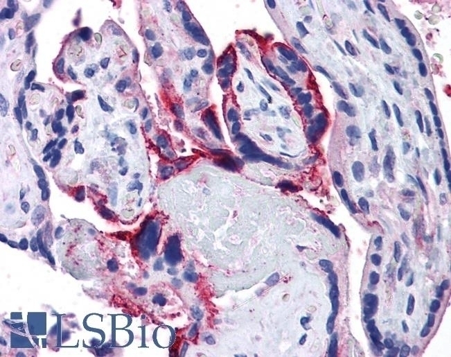 IL12B Antibody - Cat. No. 45-767 | ProSci