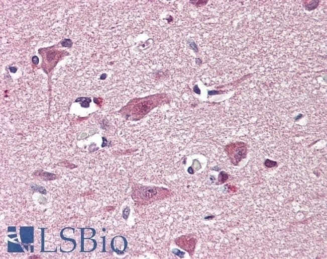 PLA2G1B Antibody - Cat. No. 46-200 | ProSci