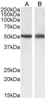 SLC7A11 Antibody - Cat. No. 46-378 | ProSci
