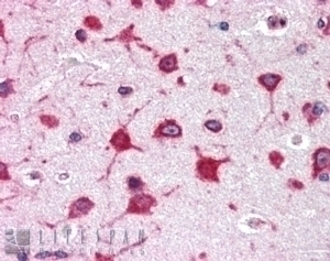 THRB Antibody - Cat. No. 46-489 | ProSci