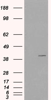 VPS26A Antibody - Cat. No. 46-579 | ProSci