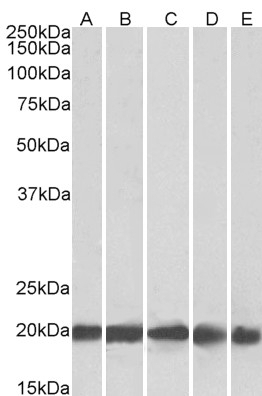 GAD67 Antibody - Cat. No. 46-779 | ProSci