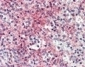 CCL5 Antibody, Monoclonal - Cat. No. 49-951 | ProSci