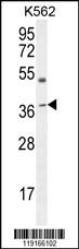 APOL6 Antibody - Cat. No. 55-042 | ProSci