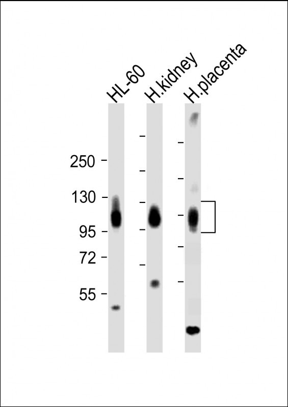 SLC3A2 Antibody - Cat. No. 55-062 | ProSci