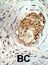 MBD3 Antibody - Cat. No. 55-160 | ProSci