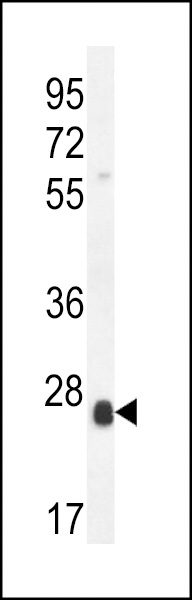 SCXA Antibody - Cat. No. 55-178 | ProSci